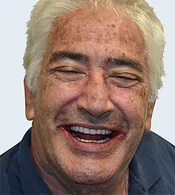 My Smile San Diego: Best Dentist in Chula Vista | Family Dentistry